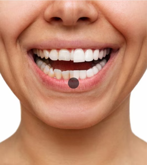 Smilo The Tooth Saviors